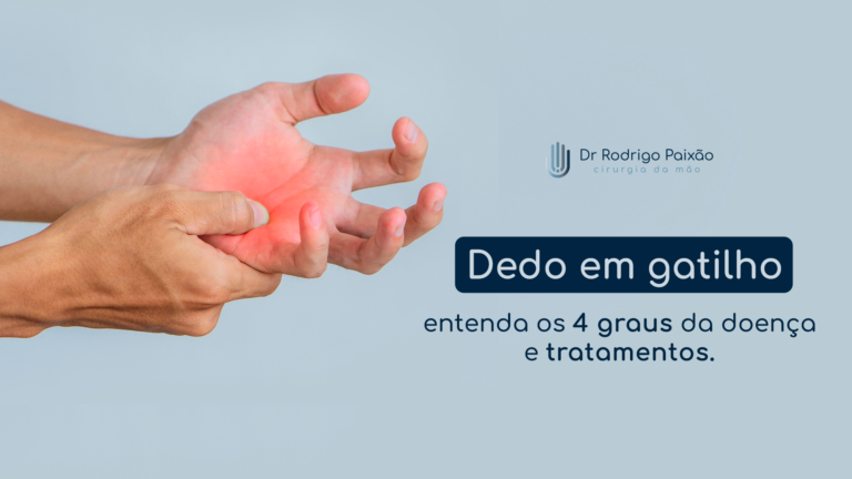 Dedo em gatilho: entenda os 4 graus da doença e tratamentos