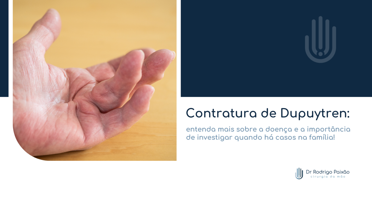 Contratura de Dupuytren: entenda mais sobre a doença e a importância de ...